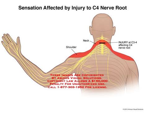 Nerve Root Distribution