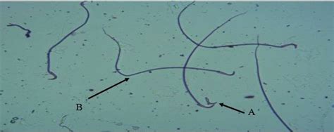 A Section Segment In The Testis Of The Rats The Treatment Of Cadmium Download Scientific