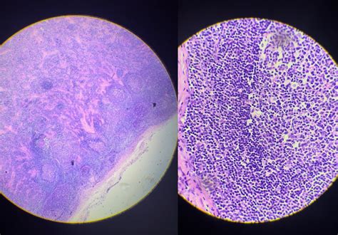 Lymph Node Diagram Quizlet