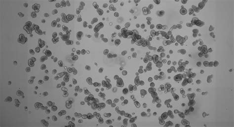 Treating Ulcerative Colitis With A Cellular Therapy Full Review Published In Iscience Renew