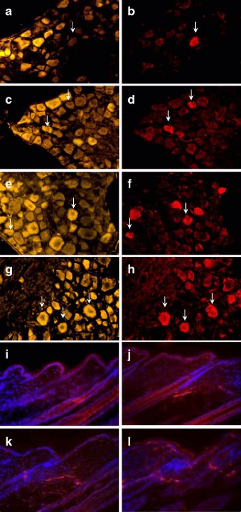 representative examples of flourogold traced dorsal root ganglia from