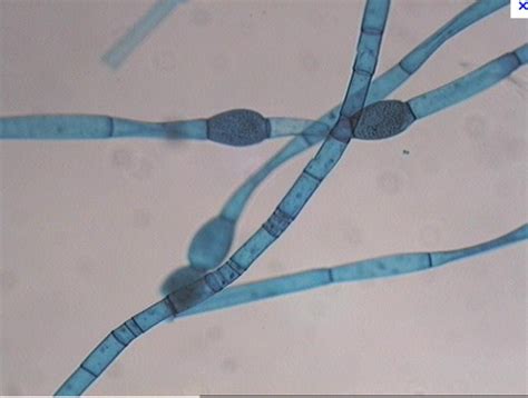 Protista Flashcards Quizlet