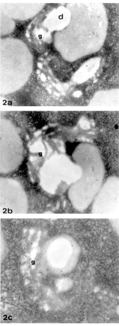 A C Photographic Reconstruction Of The Probable Secretory Granule