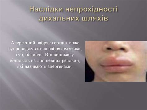 Причини порушення прохідності дихальних шляхів презентация онлайн