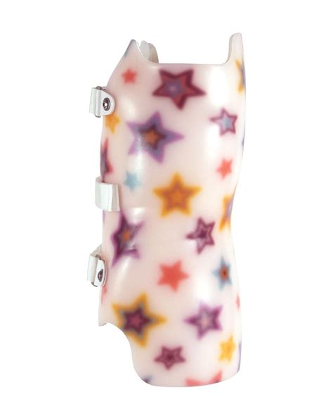 Spinal Technology Sct 3d Wilmington Style Scoliosis Brace