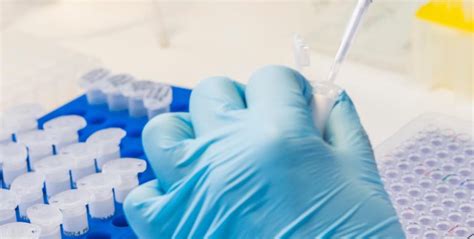 Enhancement Of Dna Amplification Efficiency By Using Pcr Additives