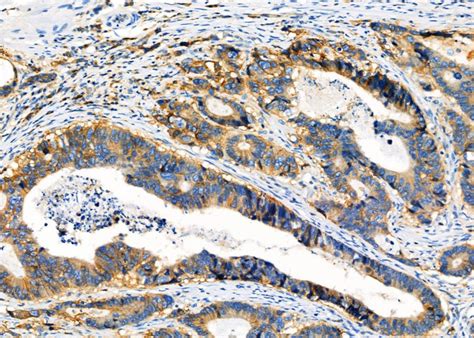 Hla Abc Polyclonal Antibody Pa5 115363