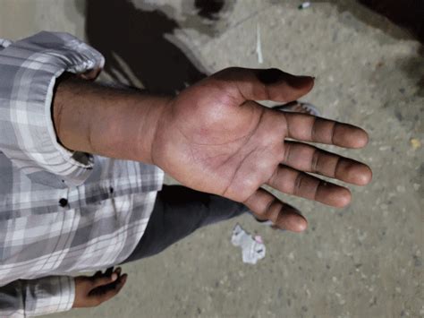 Rajasthan Police Station Physically Assaulted Behror Thana दलित युवक को थाने में 22 घंटे तक