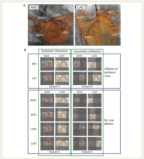 3d 2d Fluoroscopy Overlay Views Treatment And Collimation Scenarios Download Scientific