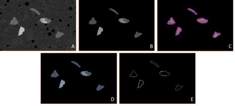 Boundary Voxel Segmentation Steps Starting From A To E Image