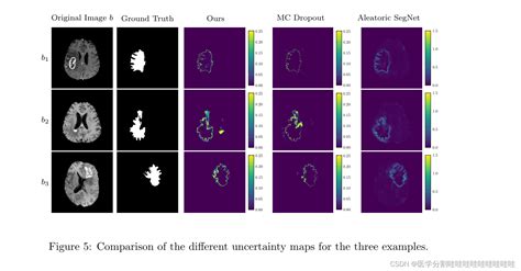 Diffusion Models For Implicit Image Segmentation Ensembles Csdn博客
