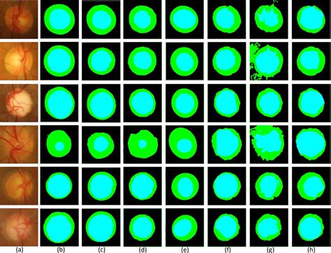 figure 2 from multi scale and multi branch convolutional neural network