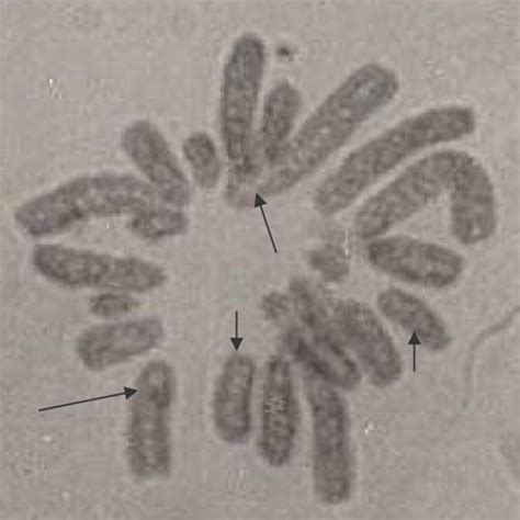 Diplotene In O Spissus The X Chromosome Arrowed Chiasma Frequency