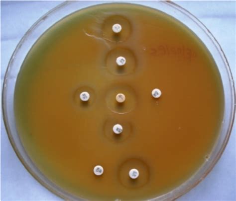 Inducer Substrate Combination Disk Test Download Scientific Diagram