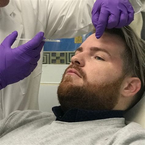 Botox For Men What Men Need To Know About Botox