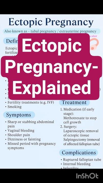 Ectopic Pregnancy Defcauses Symptoms Diagnosis Treatment Viral