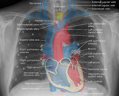 Anatomy For Radiology Chest Glass Box Medicine