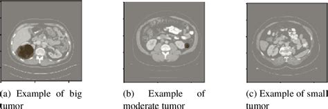 Figure 41 From Medical Image Segmentation Using Attention Based Deep