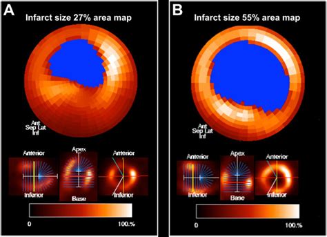 Vertical Long Axis Horizontal Long Axis And Short Axis Slices On The