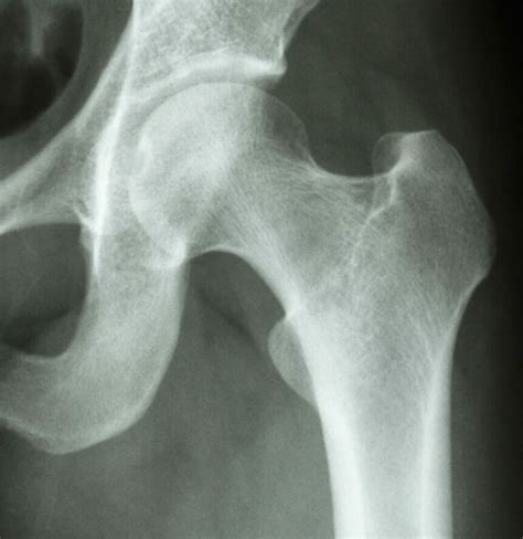 Bone Densitometry Milpark Radiology Incorporated