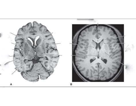 Horizontal Brain Quiz