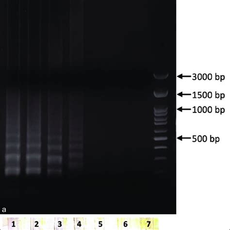 Detection Limit Of Loop Mediated Isothermal Amplification Using Heat Download Scientific