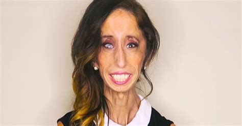 세상에서 가장 못생긴 여자 왕따에 맞선다