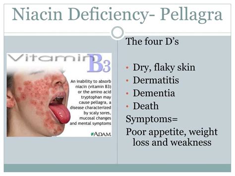 Ppt Vitamin And Mineral Notes Powerpoint Presentation Free Download