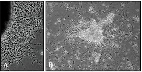 Differentiation Of Psc Derived Adherent Neurospheres A An Black