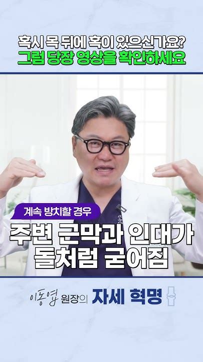 목 뒤에 혹 버섯목증후군 척추 질환의 시작점입니다｜참포도나무병원 이동엽 원장 Shorts Youtube