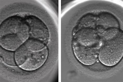 embryo evaluation part 2 cleavage stage embryos fertility matters
