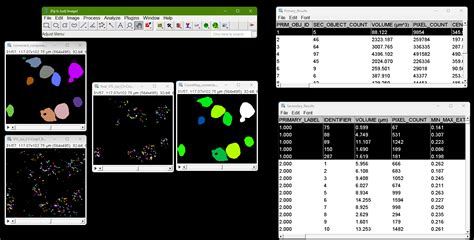 D Cell Segmentation Median Filter Limit In Voronoi Threshold Labeler Image Analysis Image