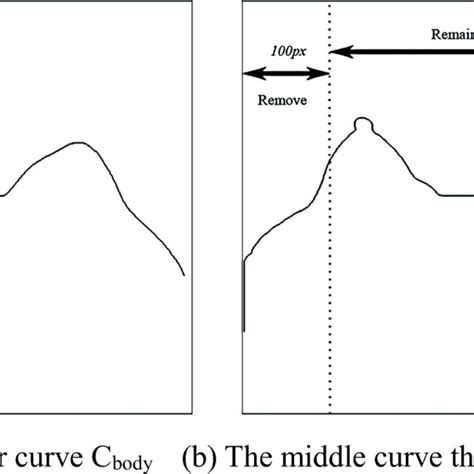 Edge Detection Of Breast Skin Between Breasts Download Scientific Diagram