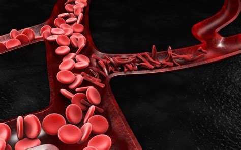 Eritrocite Scazute Divahairro