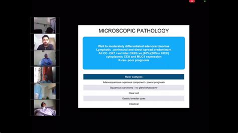 Hilar Cholangiocarcinoma Webinar Youtube