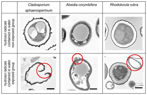 Rhodotorula Microscope