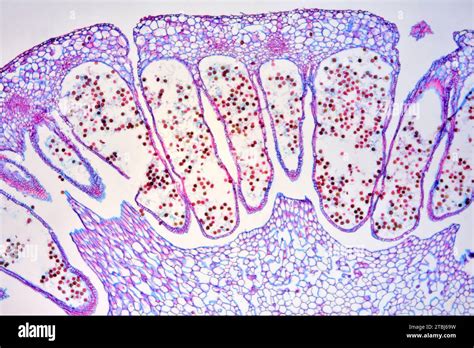 Strobilus Of Equisetum Sp With Spores Optical Microscope X40 Stock