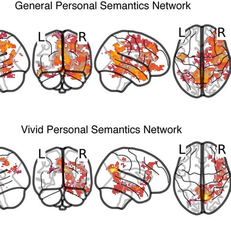 The Right Precuneus Represents Personal Semantics During Vivid