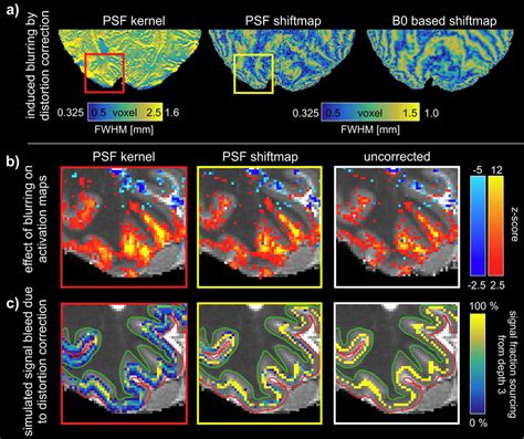 Simulated Blurring Provoked By Different Distortion Correction Download Scientific Diagram