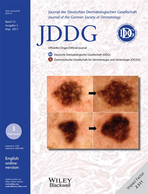 Scleroderma Dermatomyositis Overlap Syndrome With Anti‐centromere And U1 Rnp Antibodies During