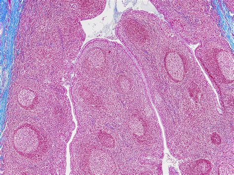 Tonsil Light Micrograph Stock Image C0543906 Science Photo Library