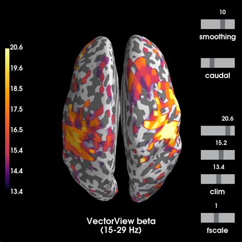 Compute Source Power Spectral Density Psd Of Vectorview And Opm Data