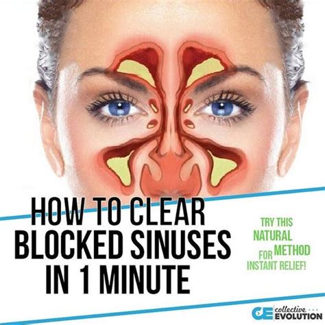 Blocked Sinus Therapy