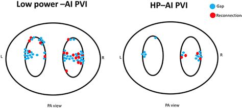 Frontiers Ablation Index Guided Ablation With Milder Targets For Atrial Fibrillation