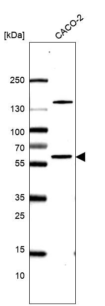 Rabbit Polyclonal Anti Clpb Antibody Buy For Research Highly