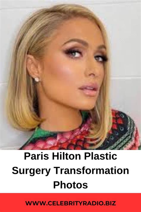 Paris Hilton Plastic Surgery Transformation Photos Plastic Surgery