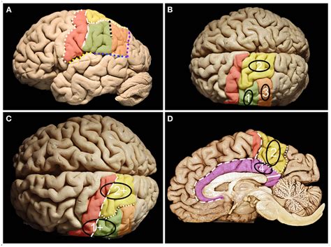 Parietal Lobe Diagram Frontal Lobe Speechfit