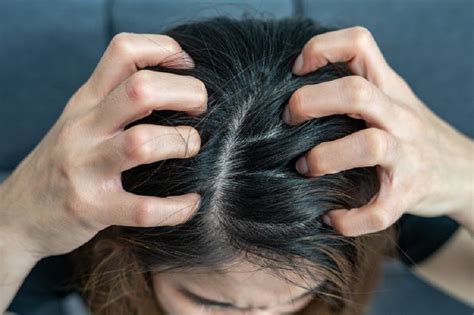 What Is The Difference Between Skin And Scalp Psoriasis
