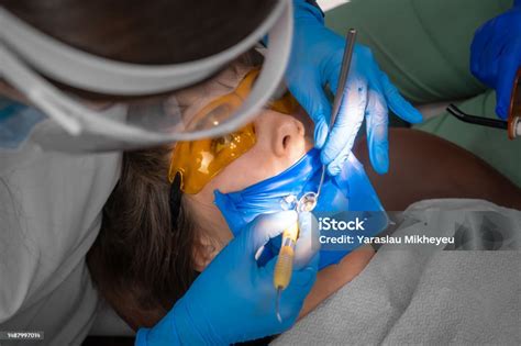 치아에 수지 기반 복합 충전재를 적용합니다 치과에 있는 젊은 여자 현대 치과 진료실에서 환자 입의 충치를 치료하는 보조원이 있는 여성 치과의사 25 29세에 대한 스톡 사진