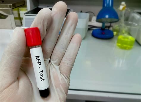 Rumah Sakit Dengan Pelayanan Berkualitas Siloam Hospitals